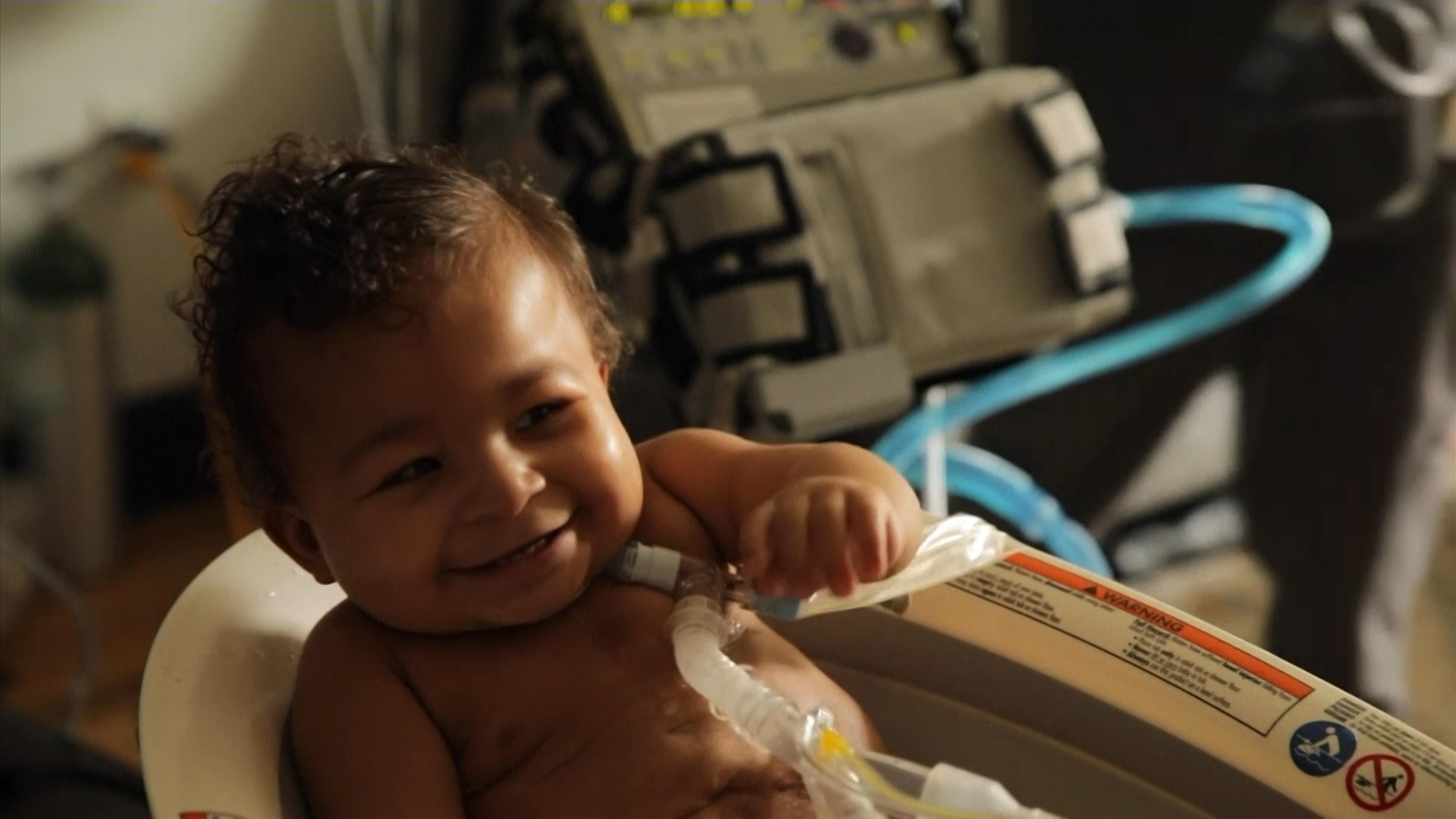 Risky at-Birth Surgery Saves Baby With Rare Disorder Risky at-Birth Surgery Saves Baby With Rare Disorder